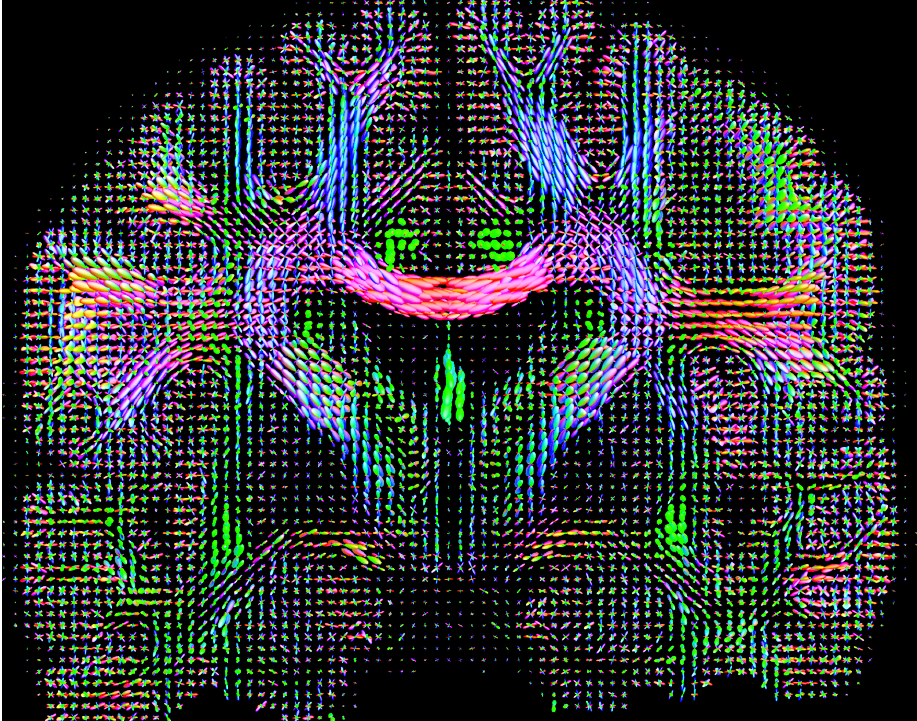 An up-close view of ALS • Discovery