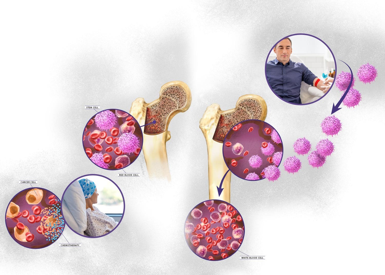 BMT: How it works • Discovery